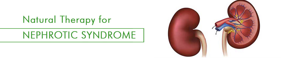 natural-therapy-for-nephro-syndrome – Om Pharma Ayur